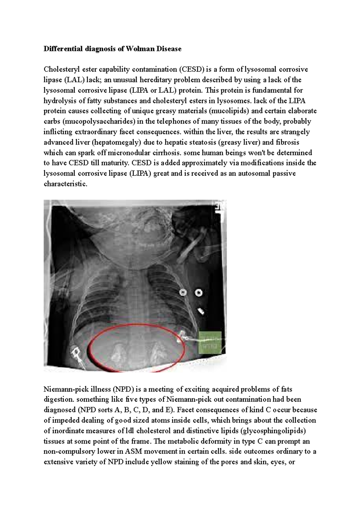 Differential diagnosis of Wolman Disease-1 - Differential diagnosis of ...