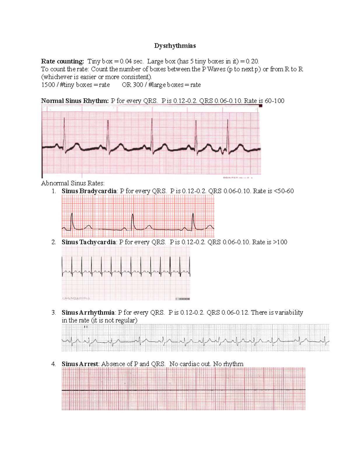 Rhythm review 2022 - Dysrhythmias Rate counting: Tiny box = 0 sec ...