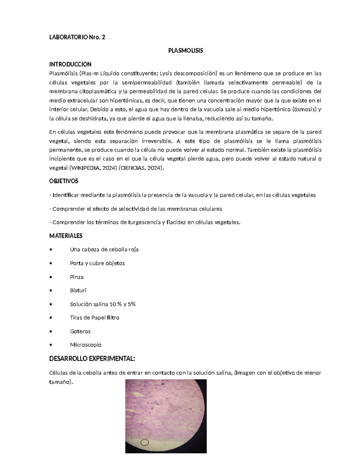 Plasmolisis - plasmolizacion y desplamolizacion de celulas vegetales ...