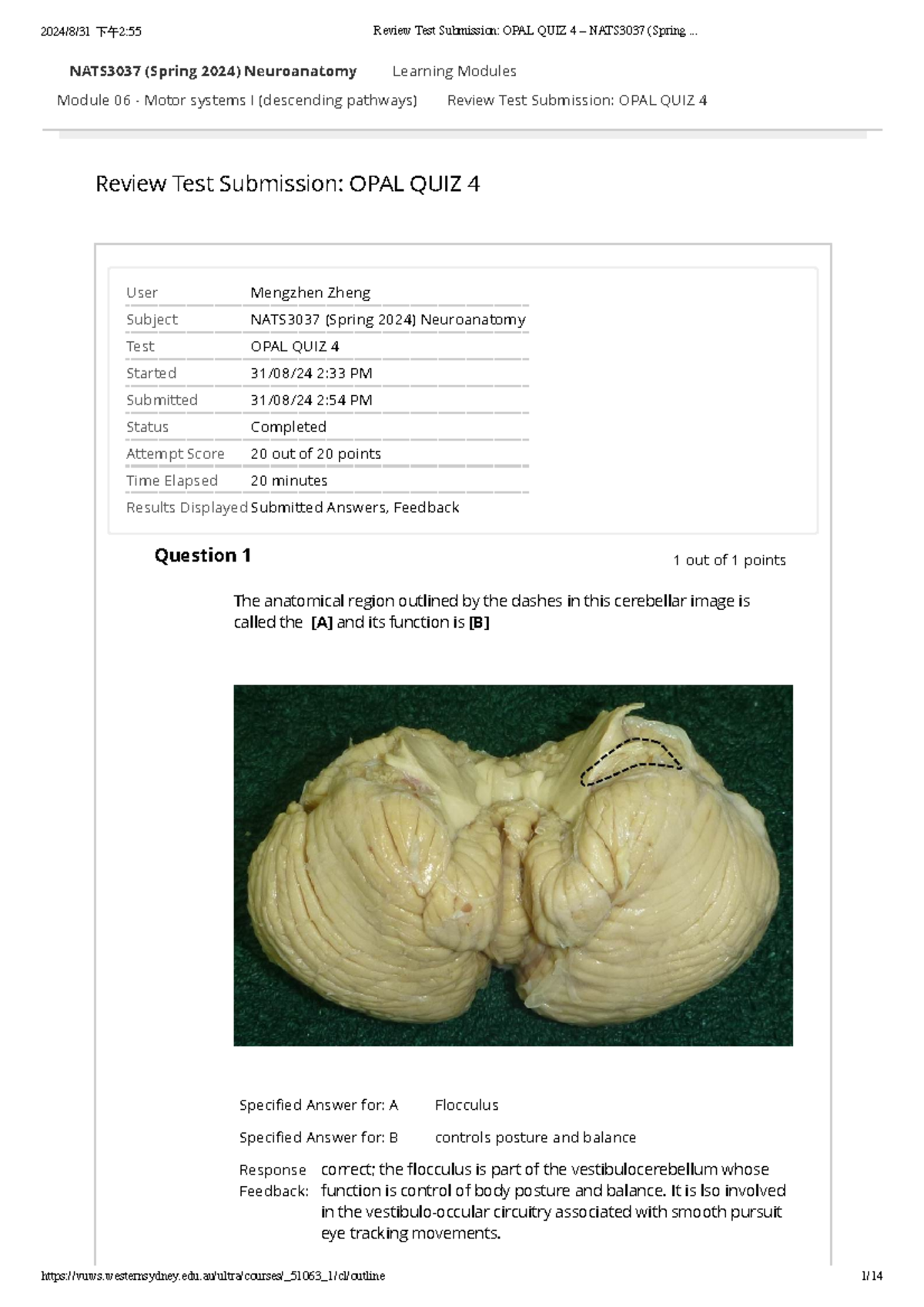 neuroanatomy lab Practice 4 - Review Test Submission: OPAL QUIZ 4 ...
