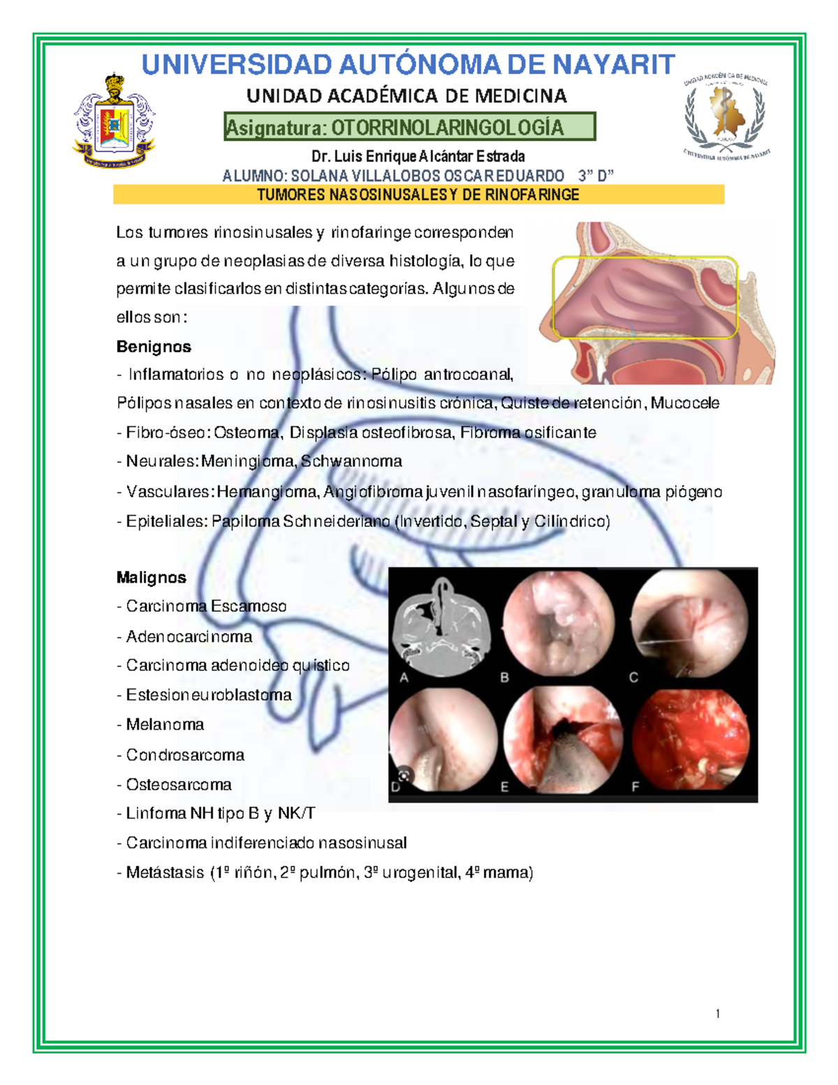 Resumen Tumores Nasosinusales Y DE Rinofaringe - Dr. Luis Enrique ...