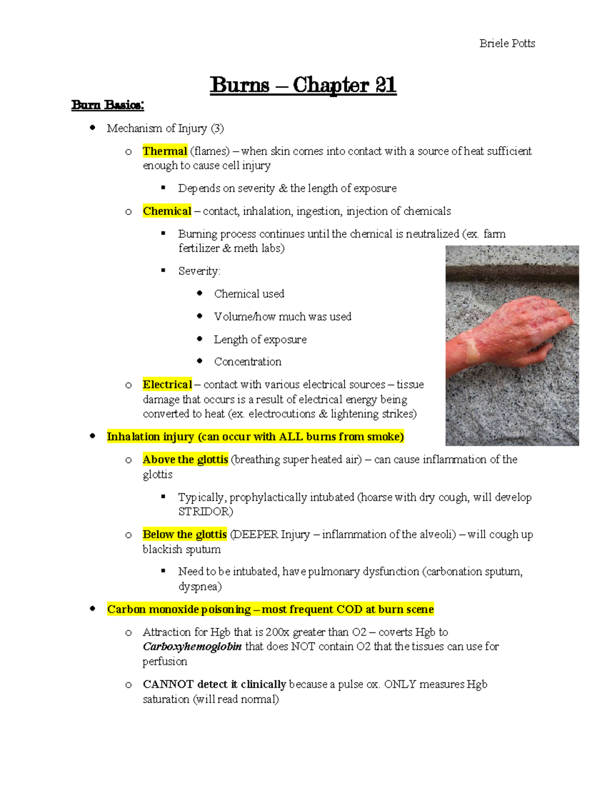 Burns SG - Burns – Chapter 21 Burn Basics: Mechanism of Injury (3) o ...