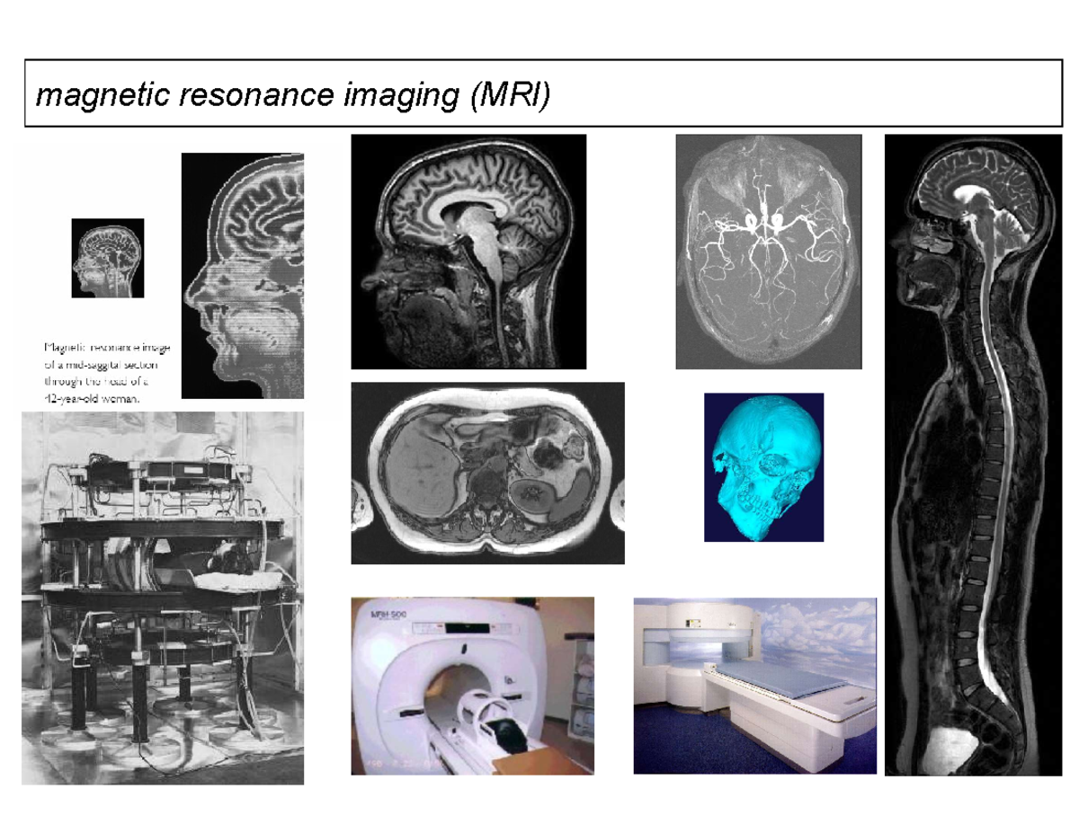 07-MRI - Mri - magnetic resonance imaging (MRI) principle active ...