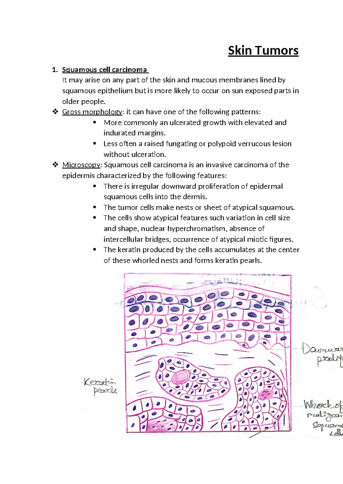 Skin Tumors - practical of pathology - Skin Tumors Squamous cell ...