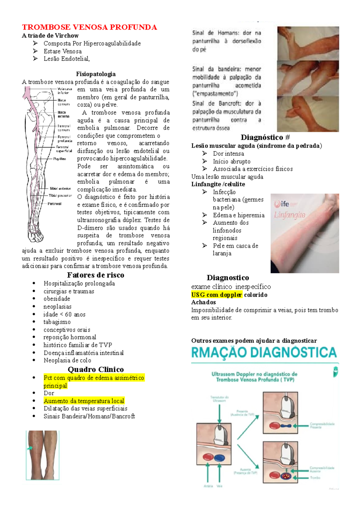 Trombose Venosa Profunda - TROMBOSE VENOSA PROFUNDA A tríade de Virchow ...