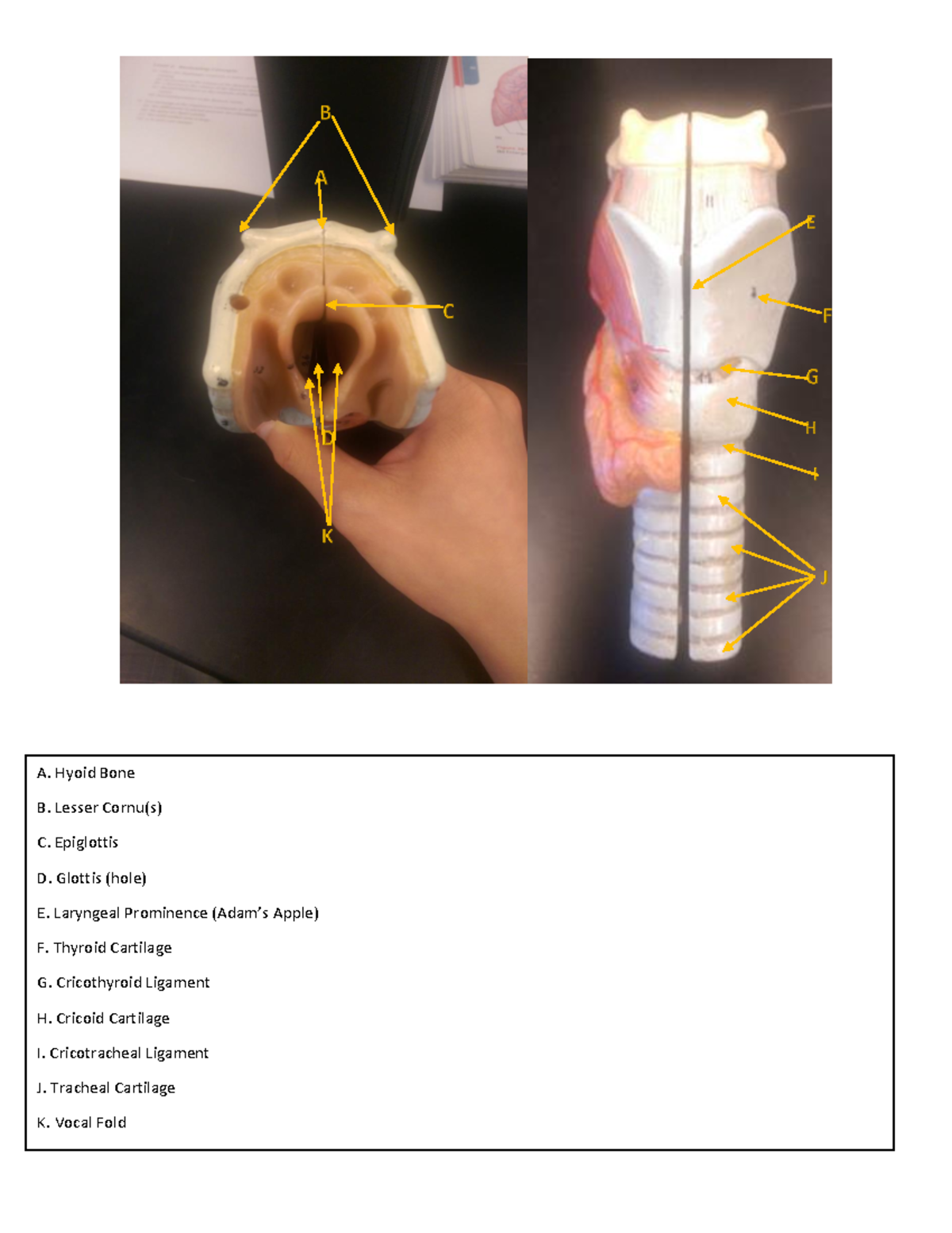 Practical 2 Respiratory System - A. Hyoid Bone B. Lesser Cornu(s) C ...