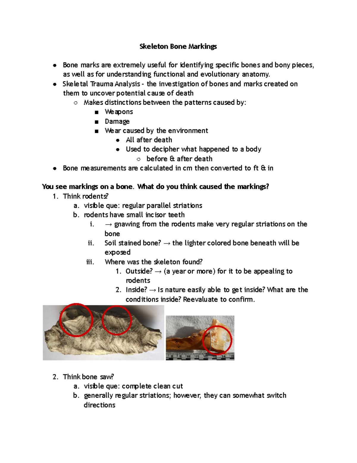 Skeleton Bone Markings - Skeletal Trauma Analysis - the investigation ...