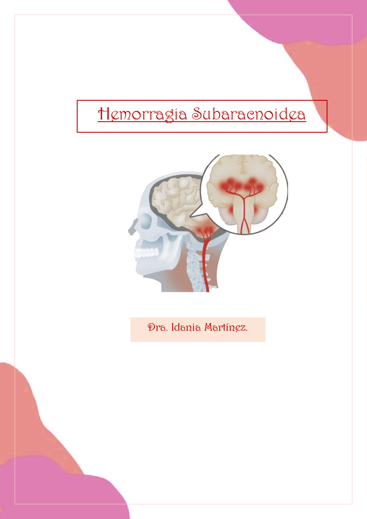 Hemorragia Subaracnoidea - 2019 0623 - Hemorragia Subaracnoidea Dra ...
