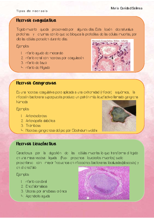 1. Tipos de Necrosis - Resumen Patología - Tipos de Necrosis Una vez ...