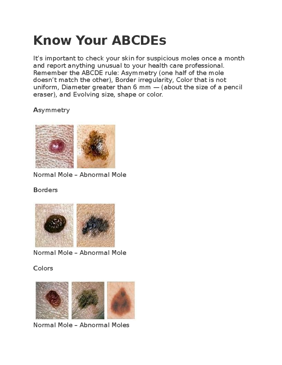 Know Your Abcdes - Know your ABCDE - Know Your ABCDEs It’s important to ...