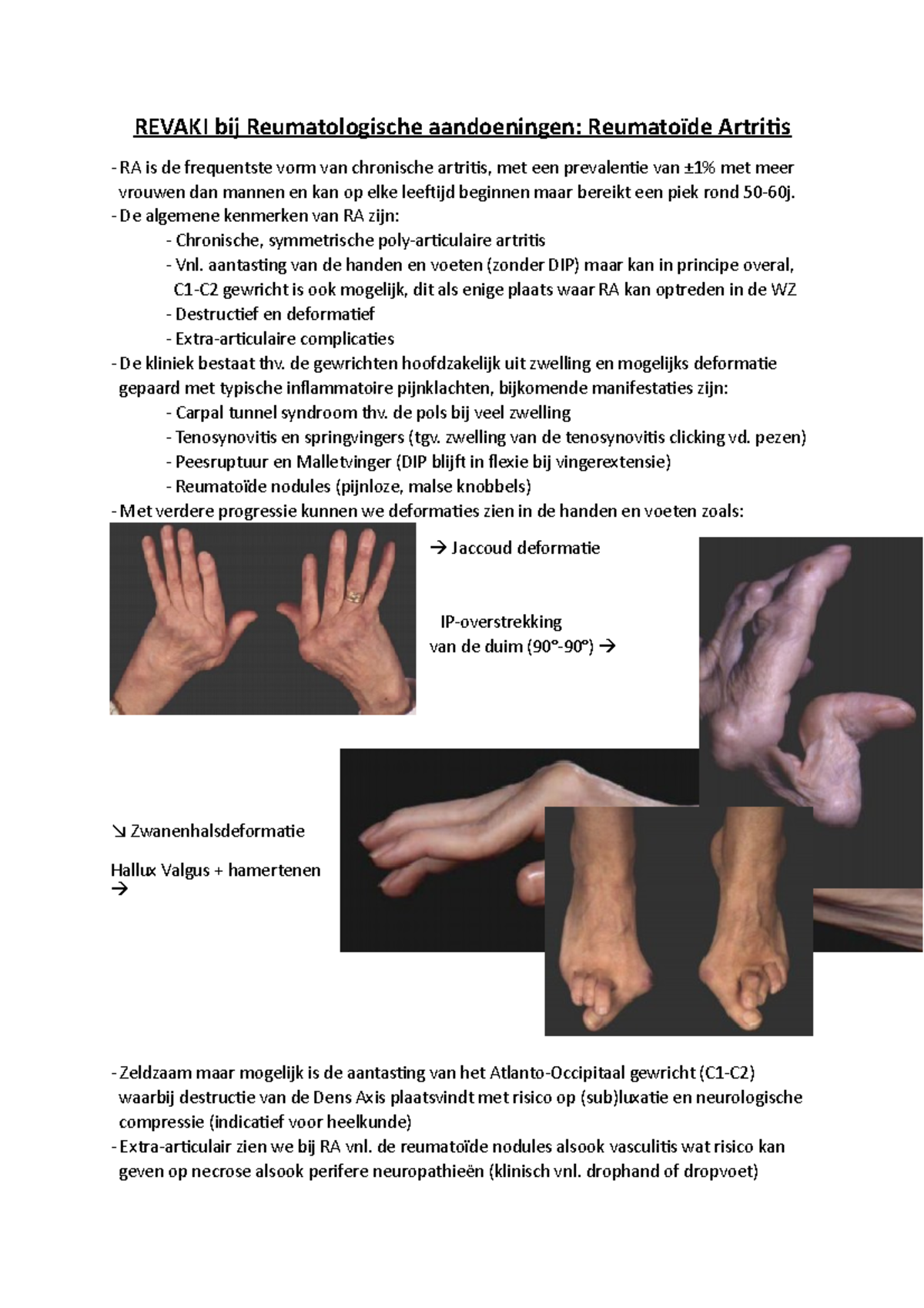Reumatoide artritis - REVAKI bij Reumatologische aandoeningen: Artritis RA is de frequentste ...