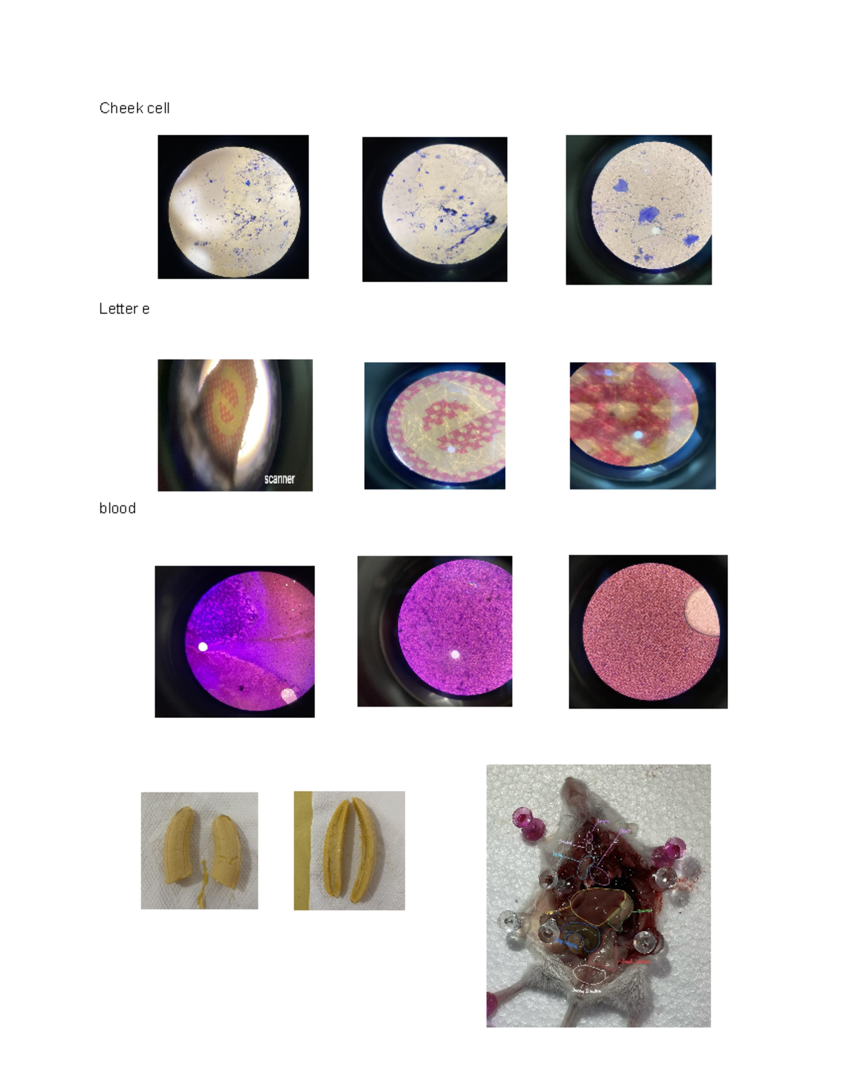 Magnification - ............ - Anatomy and Physiology - Cheek cell ...