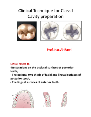 Class II Cavity Preparation Characteristics OF AN Ideal Class II ...