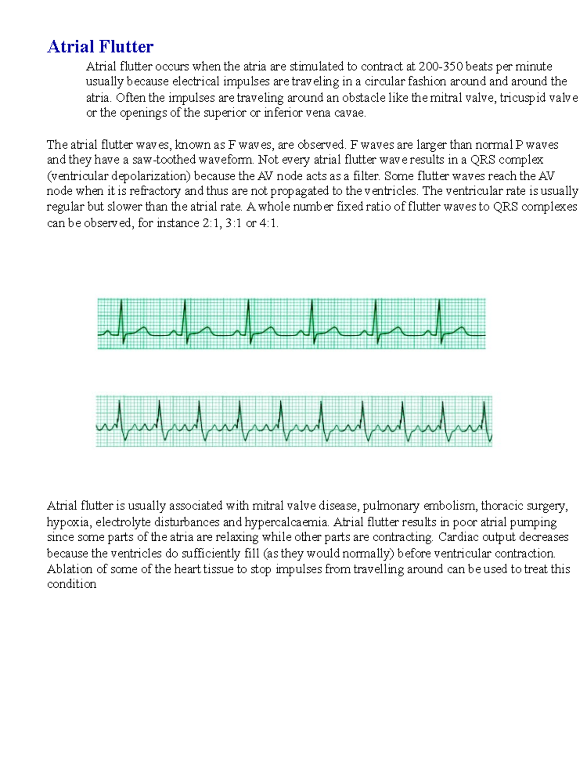 ECG reading materials with direct example - Atrial Flutter Atrial ...