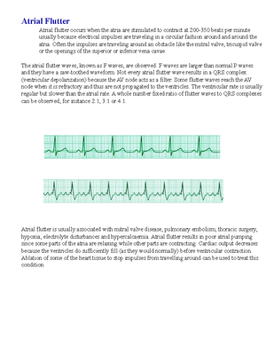 ECG reading materials with direct example for practice - ACLS EKG STUDY ...