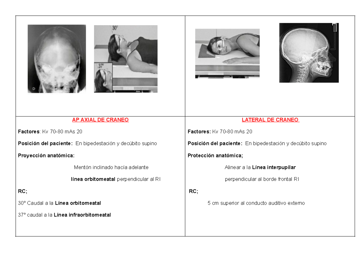 Folleto - ayuda de poscion - AP AXIAL DE CRANEO Factores: Kv 70-80 mAs ...