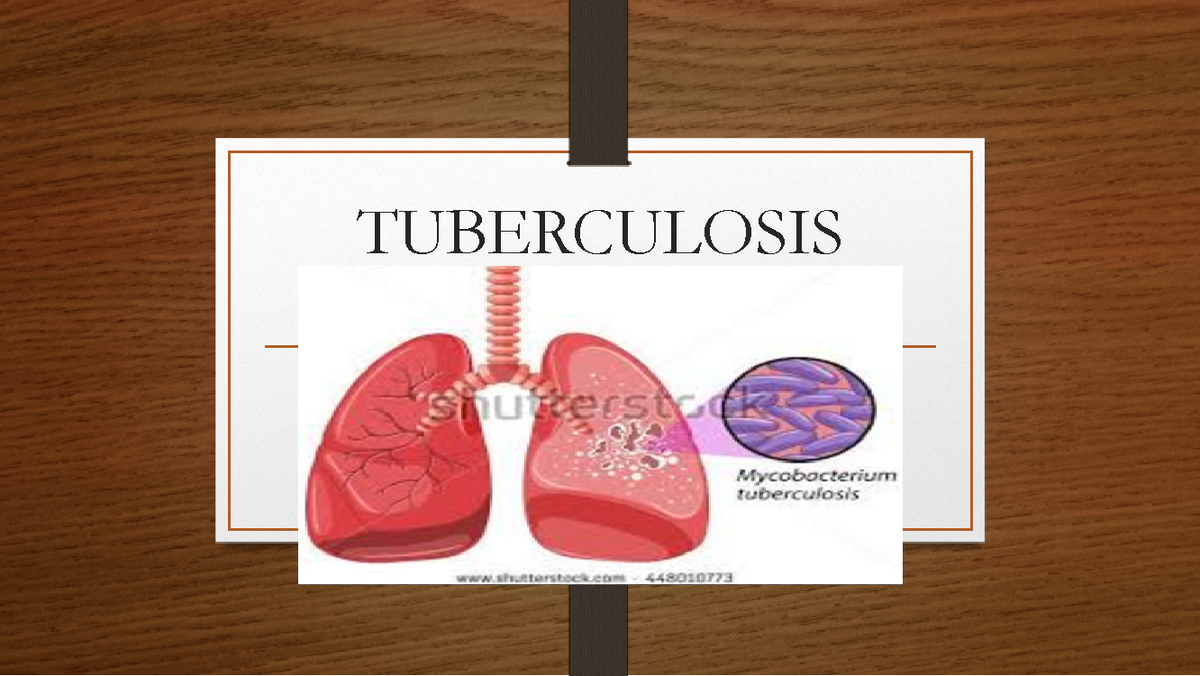Tuberculosis - TUBERCULOSIS DEFINICIÓN A nivel mundial, en 2020, se ...