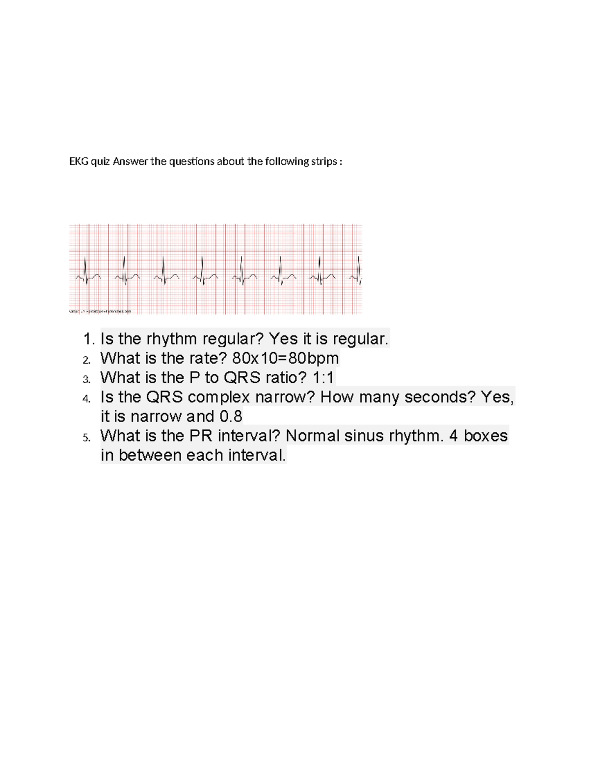 EKG - EKG interpretation - EKG quiz Answer the questions about the ...