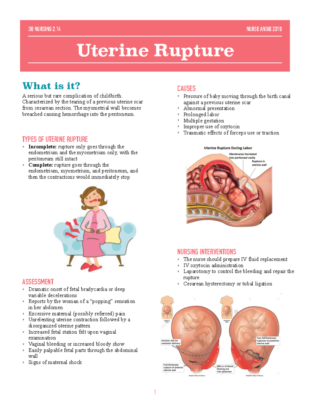 OB Nursing 2 - Lecture notes Lecture notes - 1 OB NURSING 2 NURSE ANGIE ...