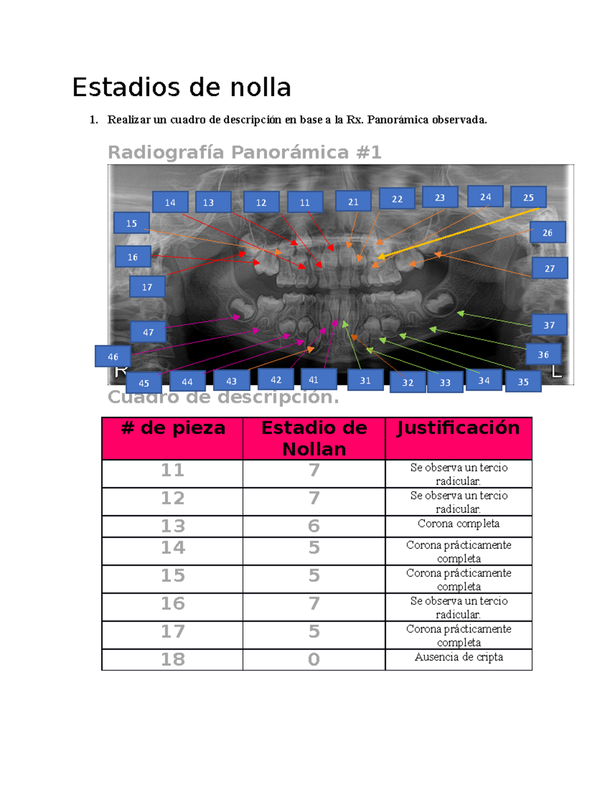 Nollan - estadios de nolla ejemplos - Estadios de nolla 1. Realizar un ...