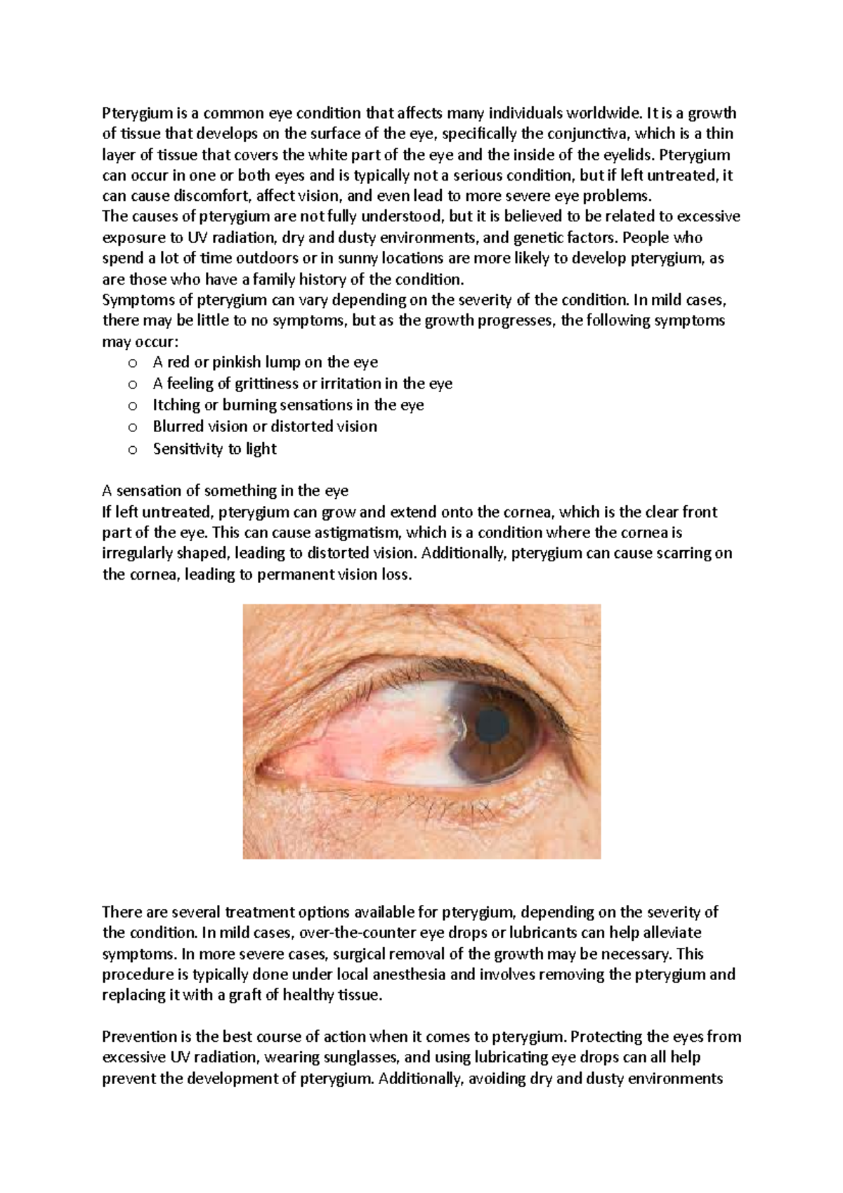 Pterygium is a common eye condition that affects many individuals ...