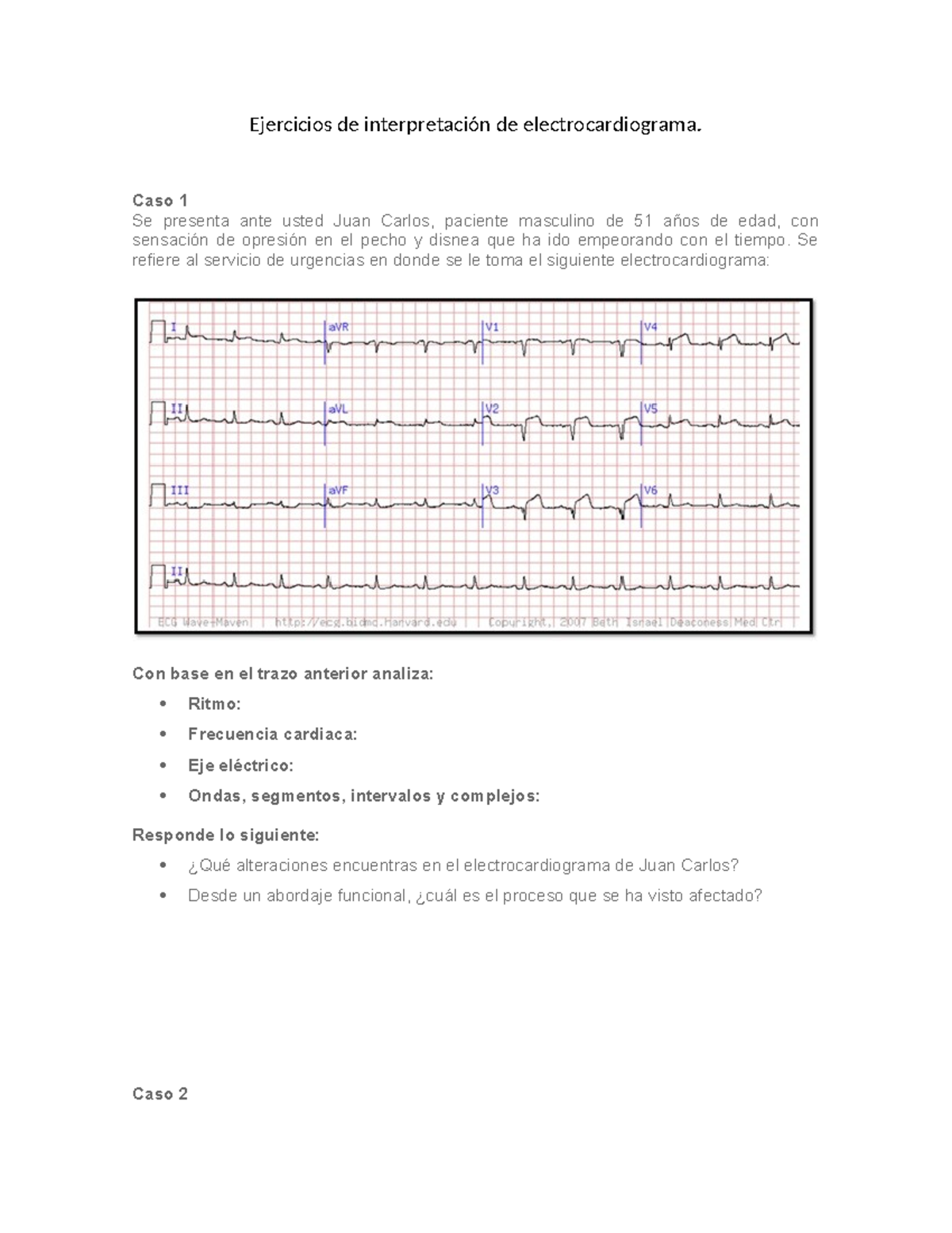 Ejercicios de interpretaci Ã³n de electrocardiograma - Caso 1 Se ...