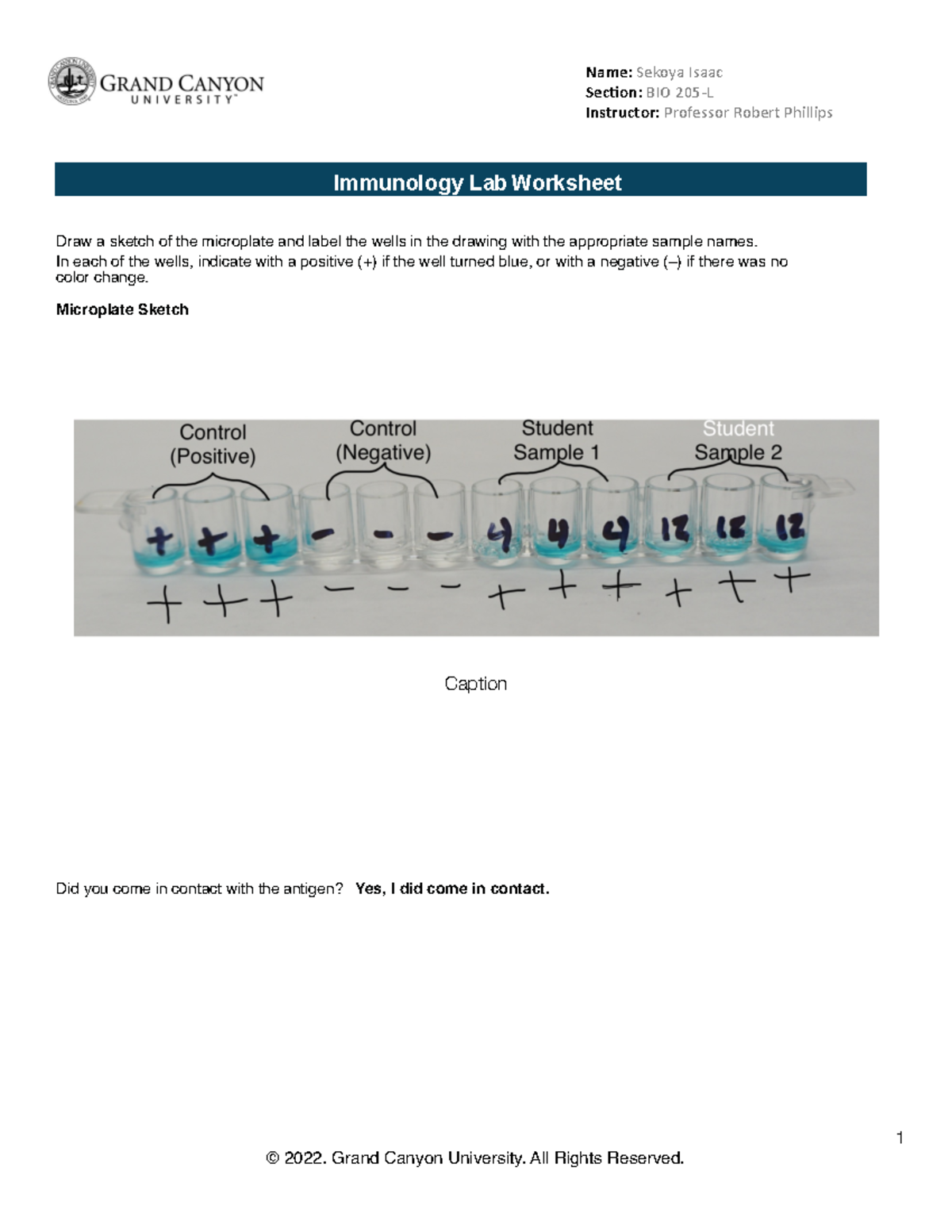 Immunology Worksheet - Sec(on: BIO 205-L Instructor: Professor Robert ...