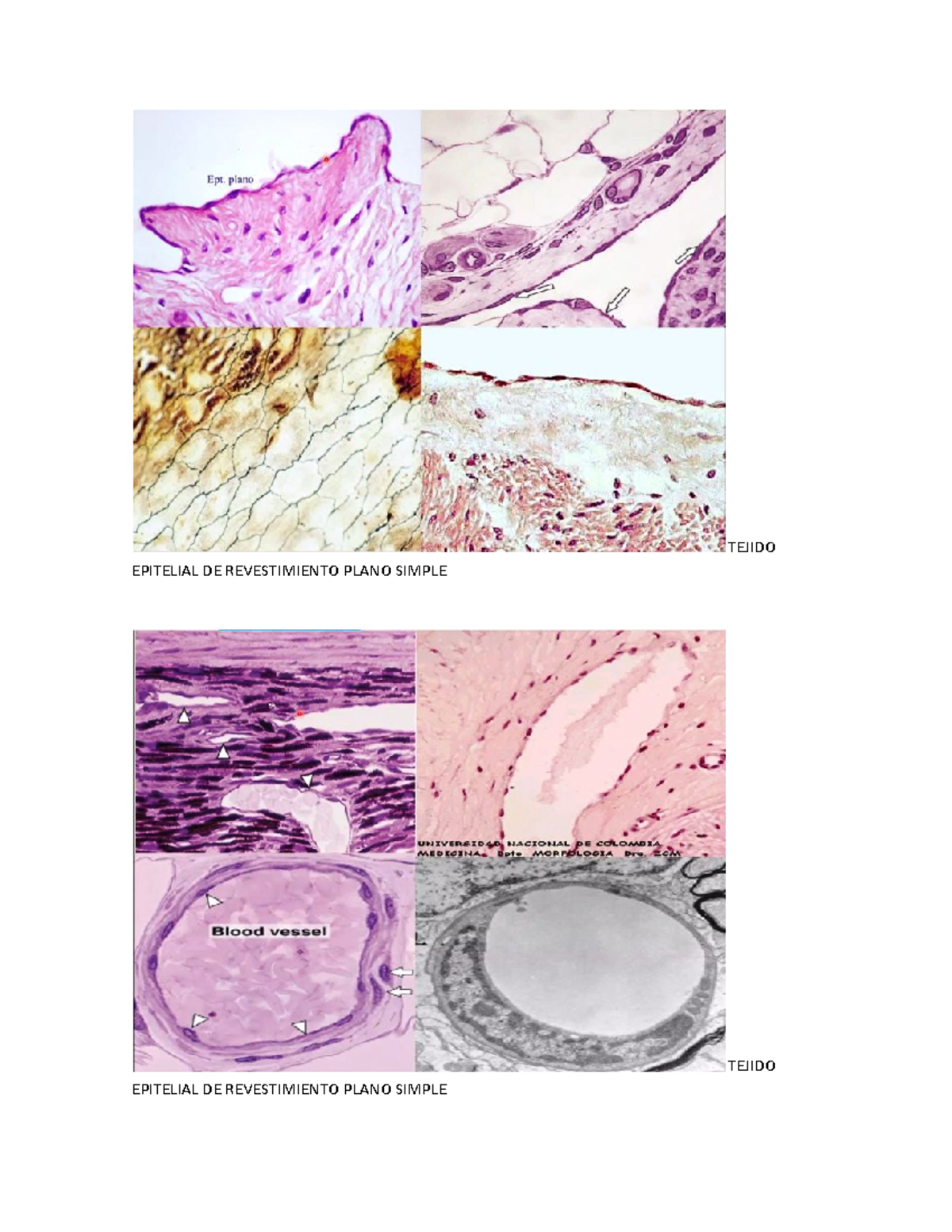 histologia-tejidos-4 - TEJIDO EPITELIAL DE REVESTIMIENTO PLANO SIMPLE ...