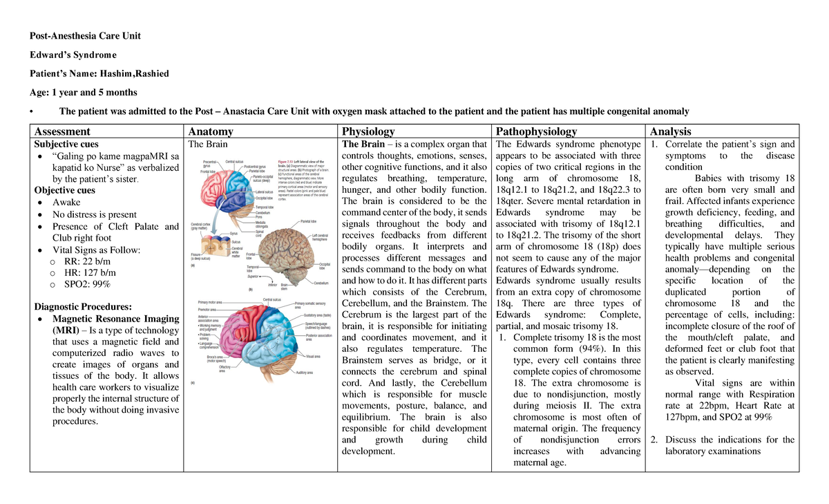 Trisomy 18, Edward's Syndrome - PACU 10th Rotation - Post-Anesthesia ...