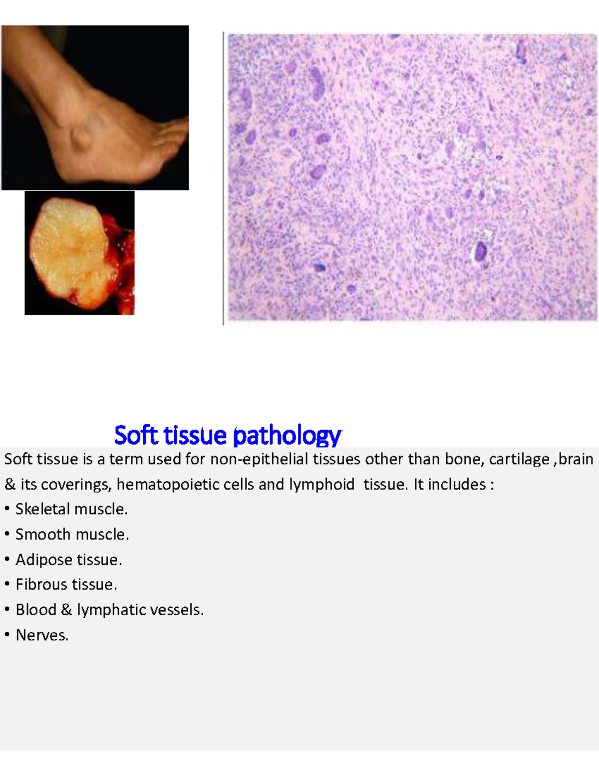 Bone pathology Soft tissue pathology - Soft tissue pathology Soft ...