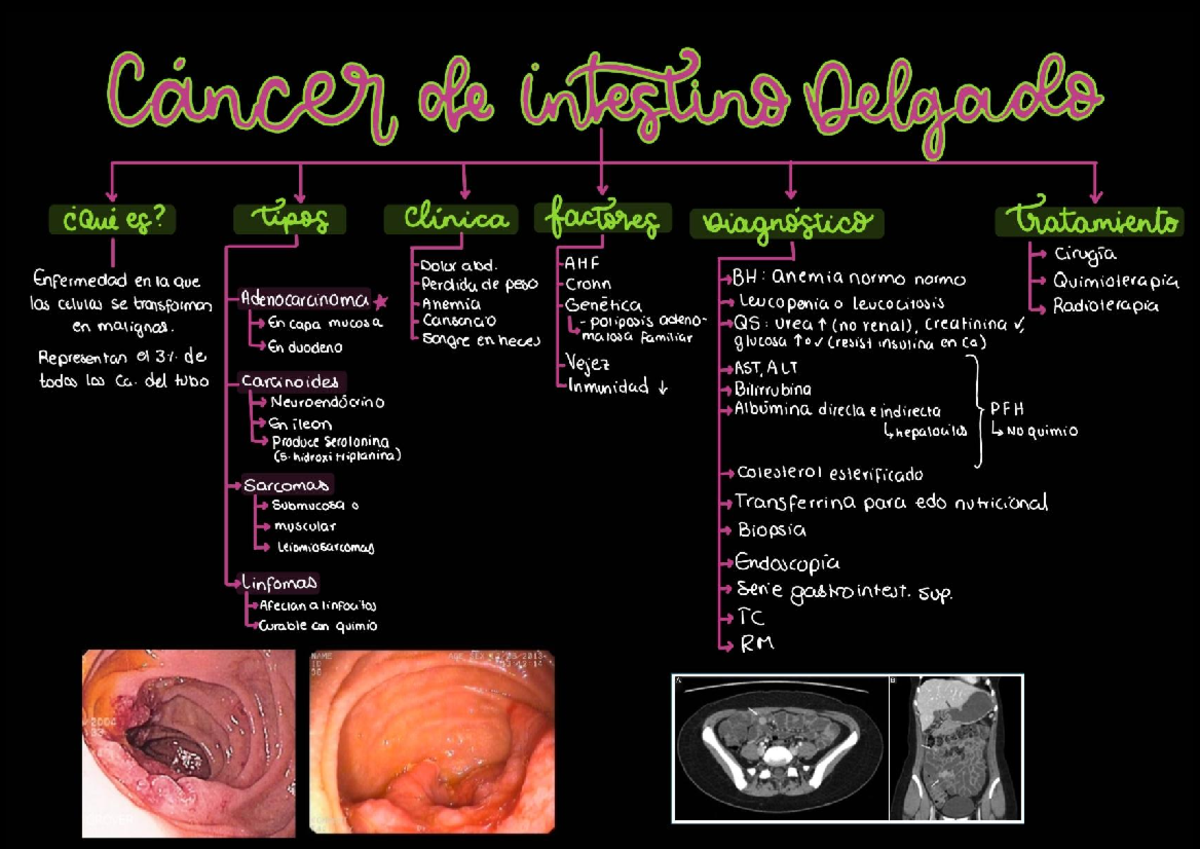 Cáncer de intestino delgado - Gastroenterología - Studocu