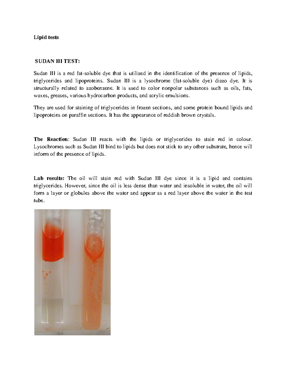 1849 Sudan III - Practical three - Lipid tests SUDAN III TEST: Sudan ...