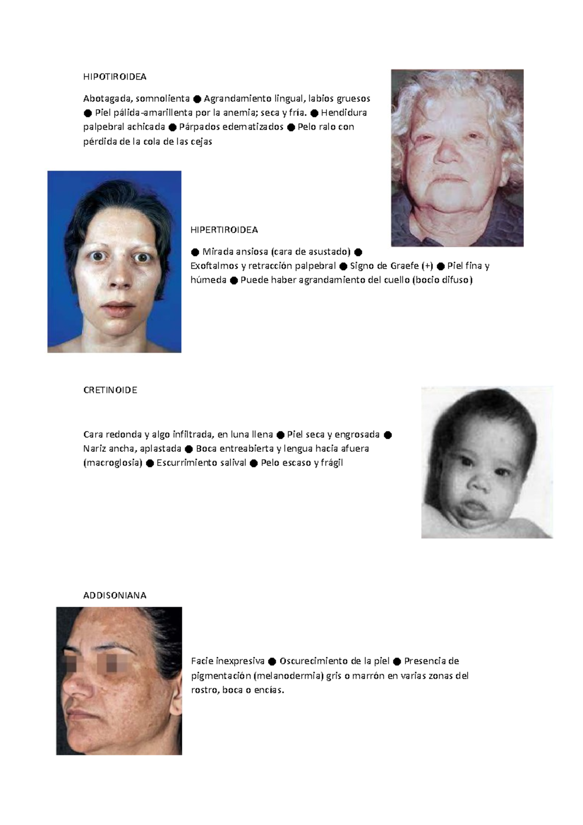 Hipotiroidea - algunas enfermedades - HIPOTIROIDEA Abotagada ...