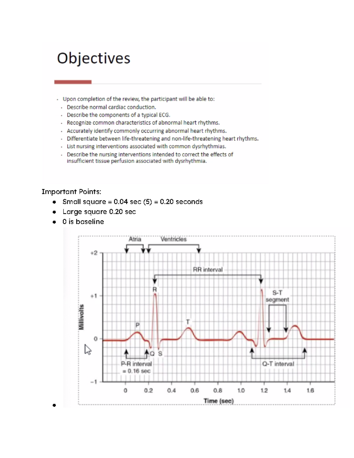 EKG Class Notes - hello - Important Points: Small square = 0 sec (5 ...