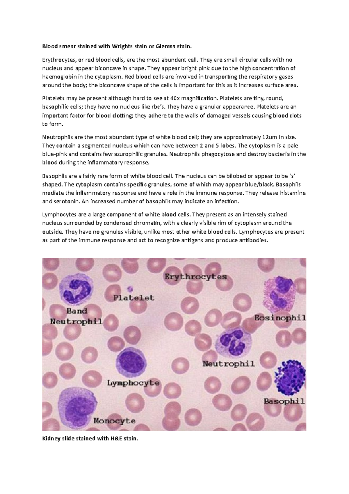 Histology Draft Answers - Blood smear stained with Wrights stain or ...