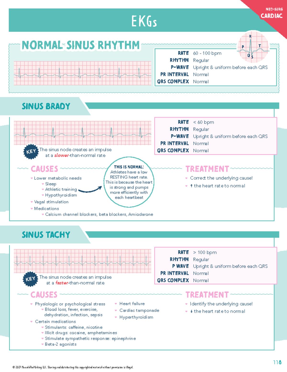 NUR CLASS NOTES - EKGs NORMAL SINUNORMAL SINUS RHYTHMS RHYTHM RATE 60 ...