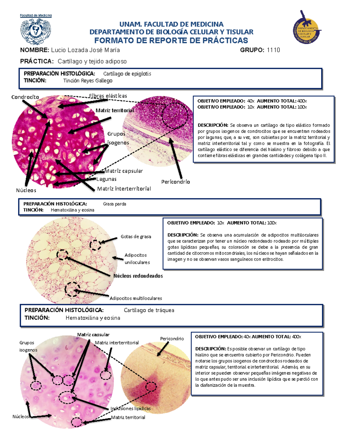 Cortes histológicos de cartilago y tejido adiposo. (primera parte ...