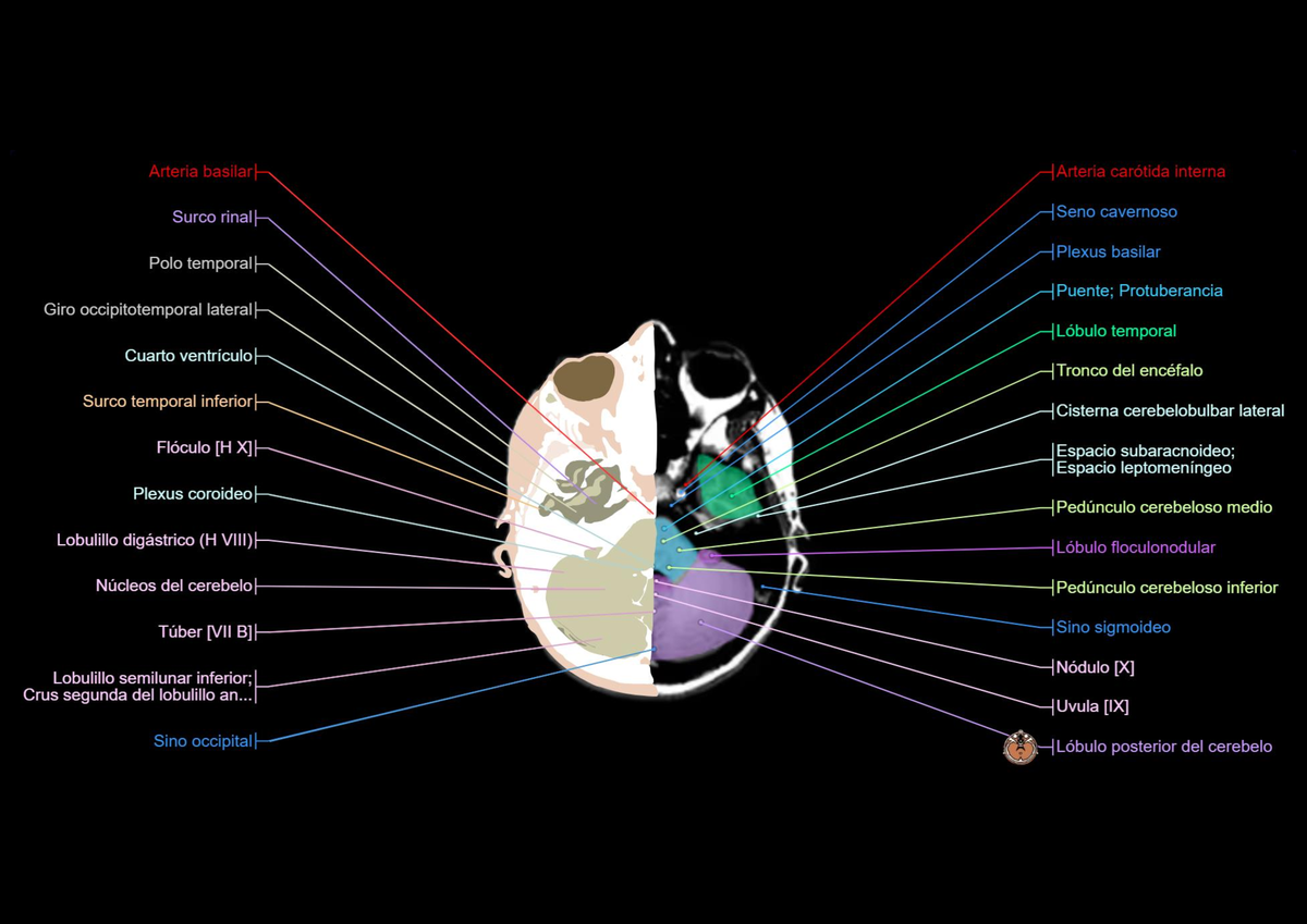 corte transversal cráneo - Arteria carótida interna Arteria basilar ...