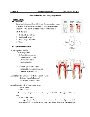 Operative Lec(4) - Lecture 4 Operative dentistry د. محمد عبدالمنعم ...