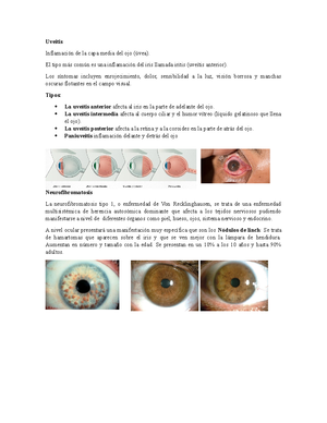 Generalidades - Generalidades Partes de la coroides - [ ] Lamina ...