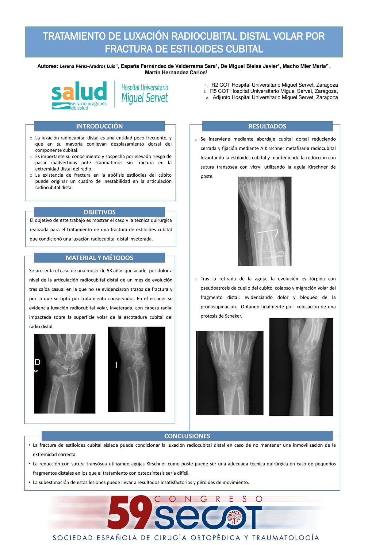 Tratamiento luxación - TRATAMIENTO DE LUXACIÓN RADIOCUBITAL DISTAL ...