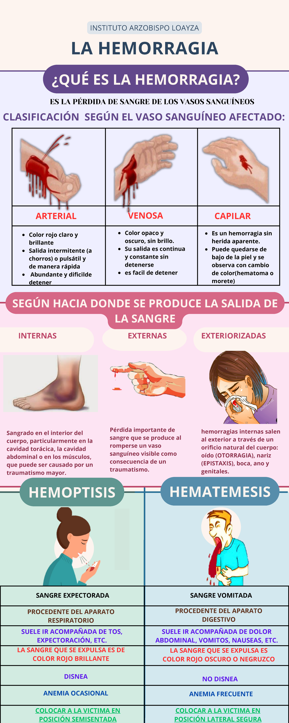 Infografia DE LA Hemorragia - ARTERIAL ¿QUÉ ES LA HEMORRAGIA ...