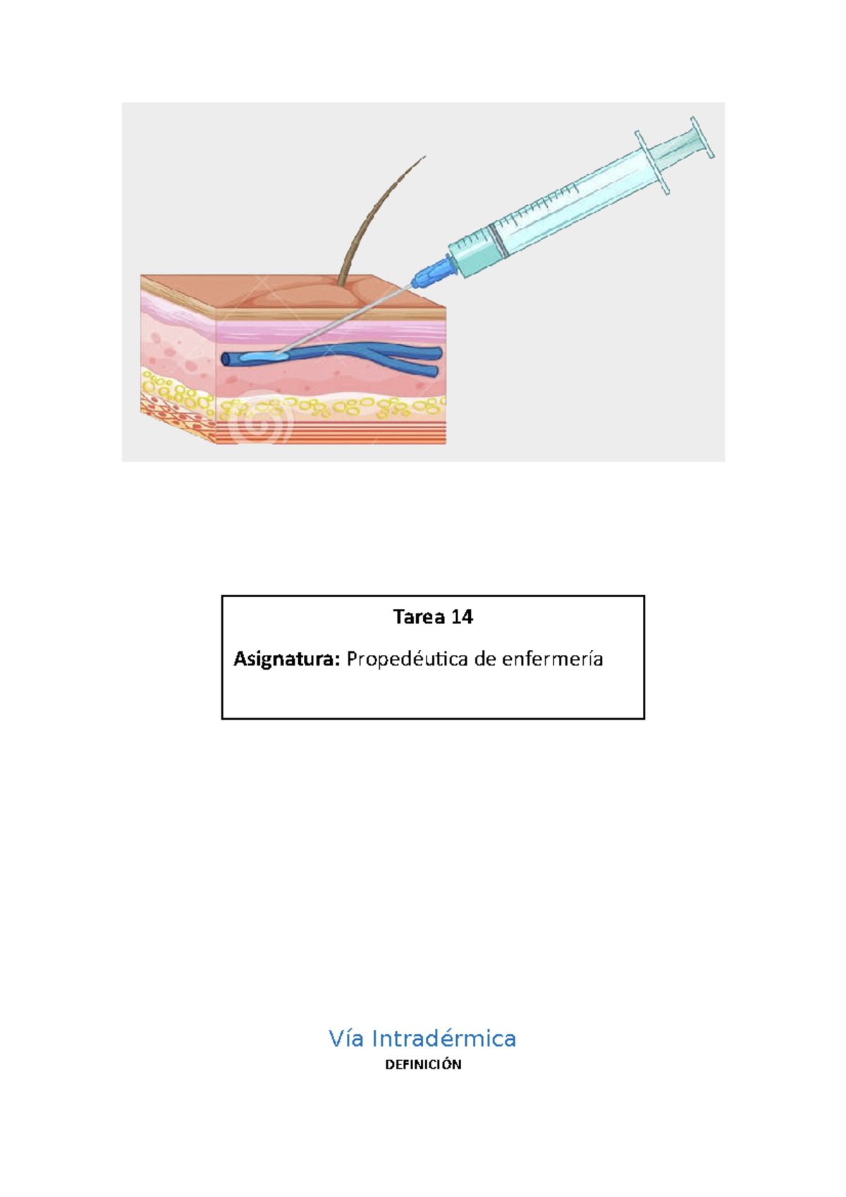 Intradermica - Vía Intradérmica DEFINICIÓN Tarea 14 Asignatura ...