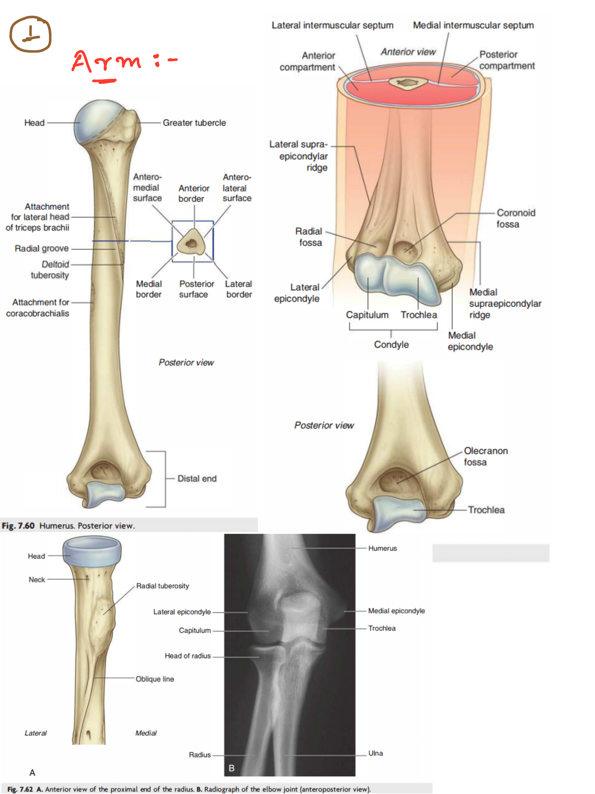 Physiology of Arm - The long head originates from the infraglenoid ...