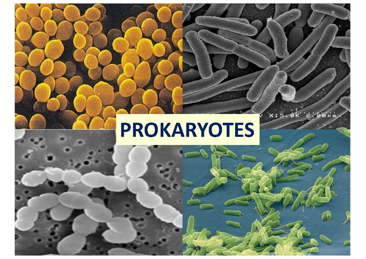 Lesson 1 Prokaryotes 221228 12000 1 - Fotos PROKARYOTES Fotos ...