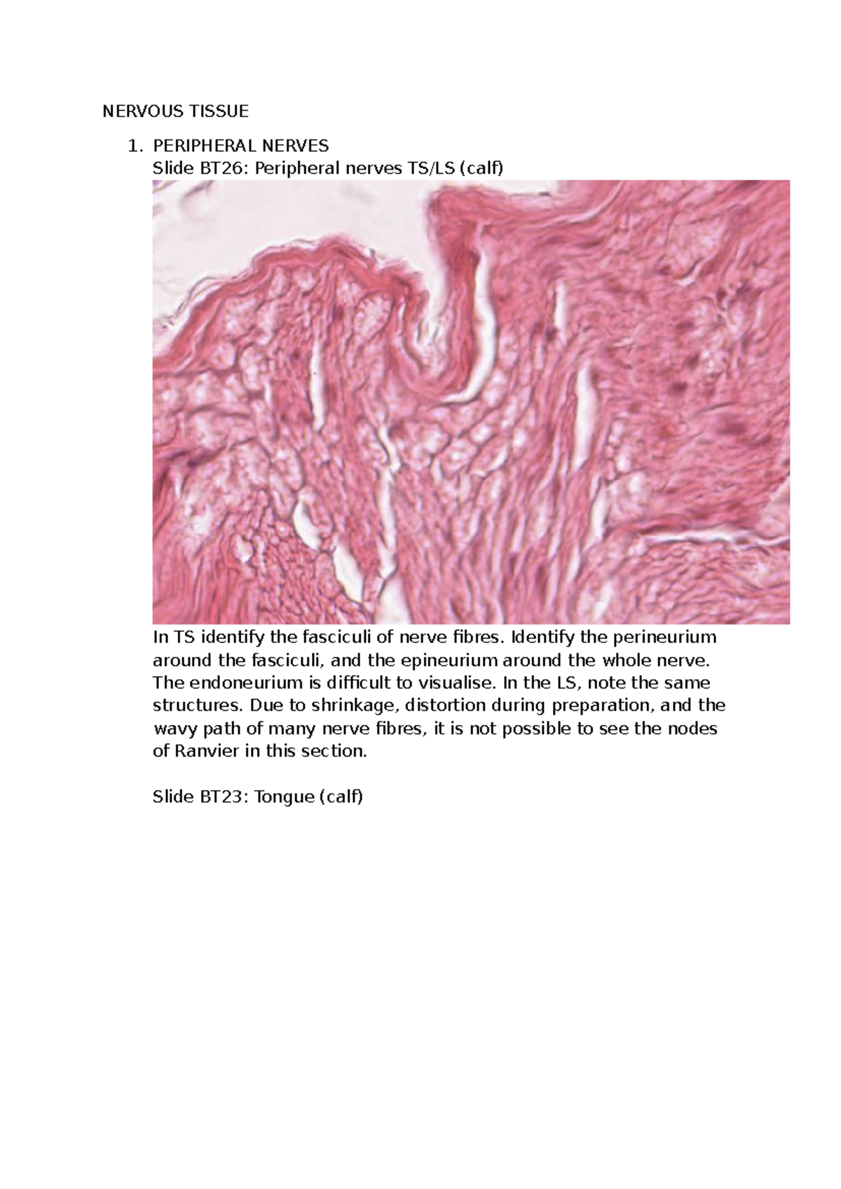 AGRC1041 Practical Note 4 - NERVOUS TISSUE 1. PERIPHERAL NERVES Slide ...