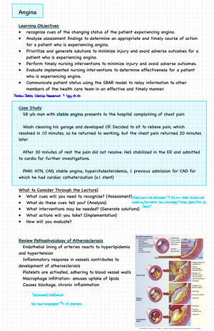 Nurs311 vte and pe - lecture notes - © 2023 Nurse Well Versed. For ...
