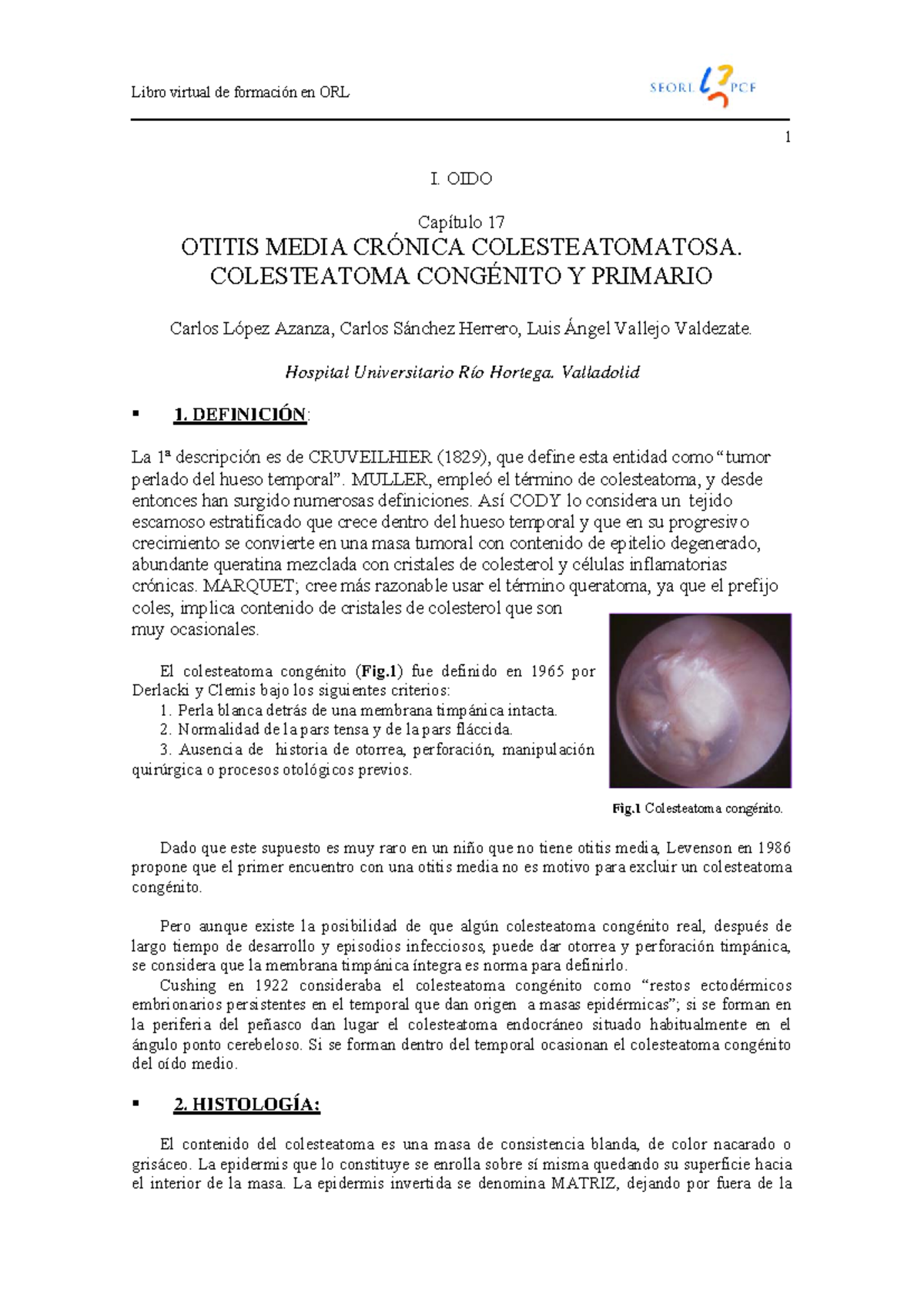 017 - Otitis Media Crónica Colesteatomatosa. Colesteatoma Congénito Y ...