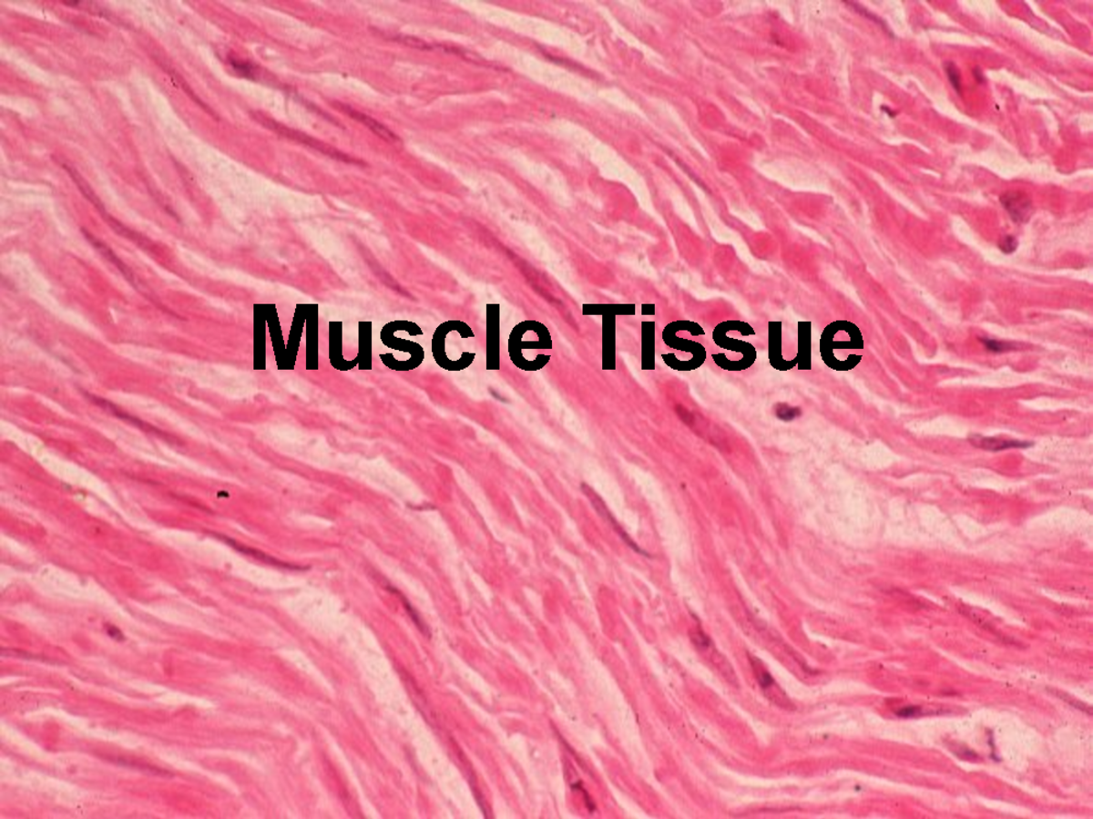 7 Muscle Tissue - Muscle Tissue Types of Muscles Skeletal muscle ...