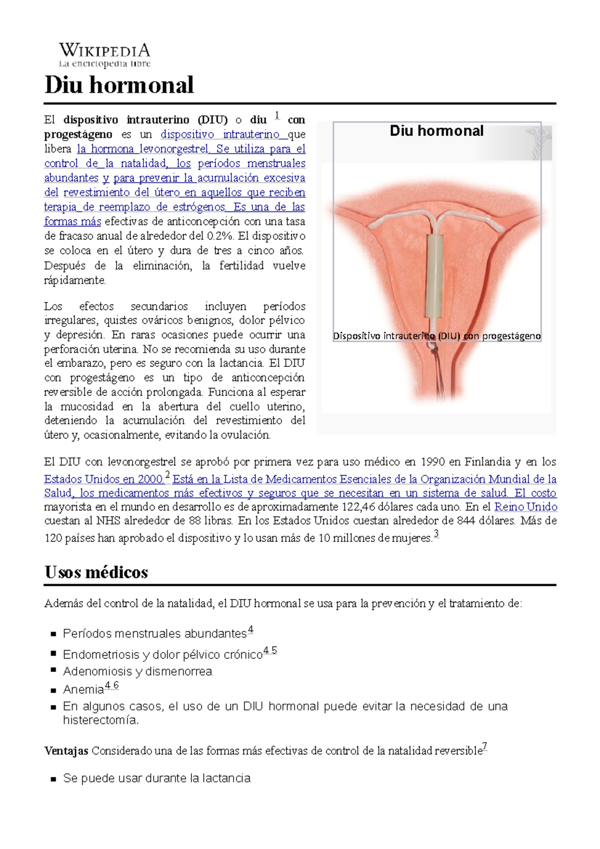 Diu hormonal - Diu hormonal Dispositivo intrauterino (DIU) con ...